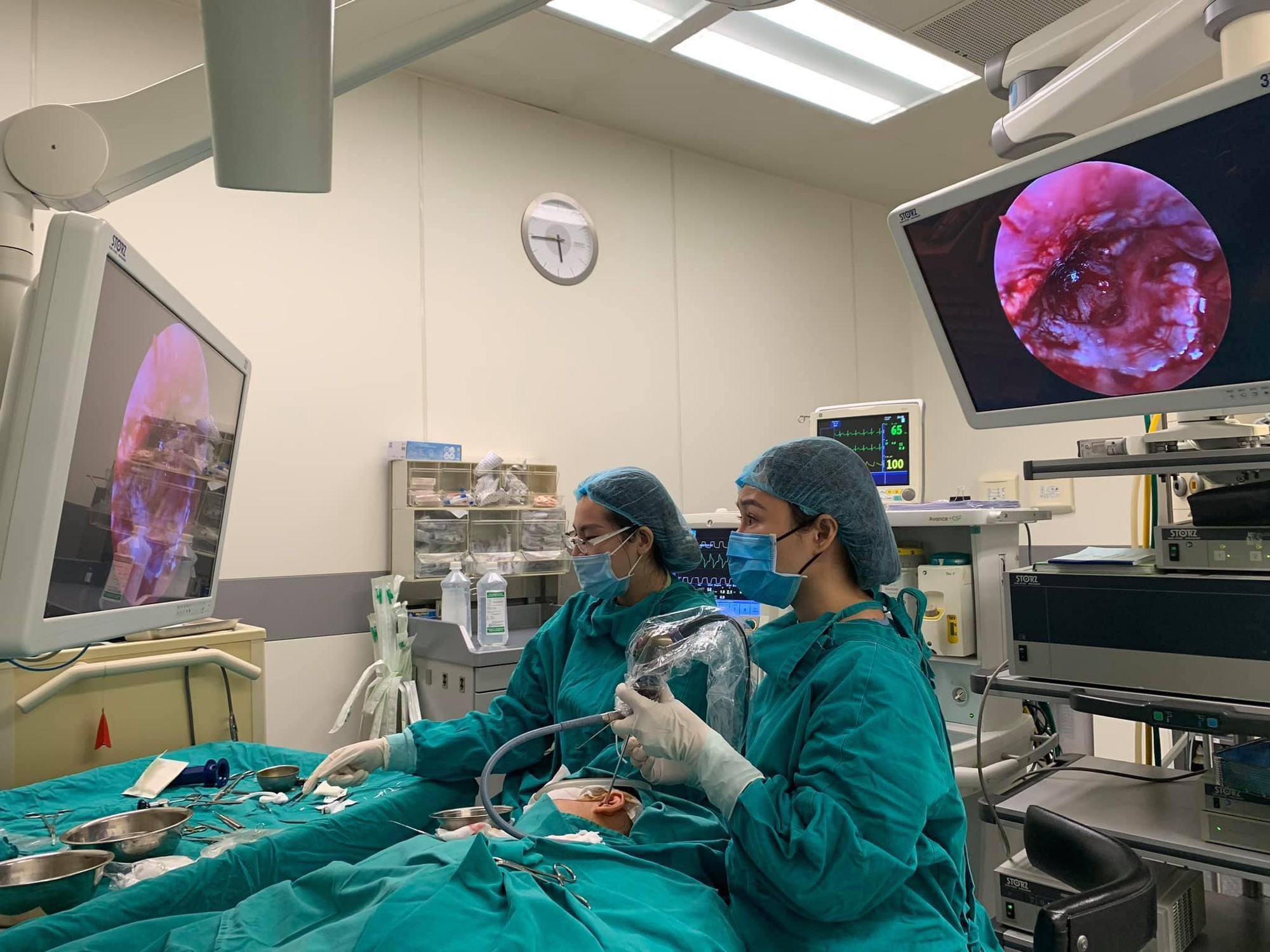 Chữa điếc nghe kém bằng phẫu thuật chỉnh hình xương con theo phương ...