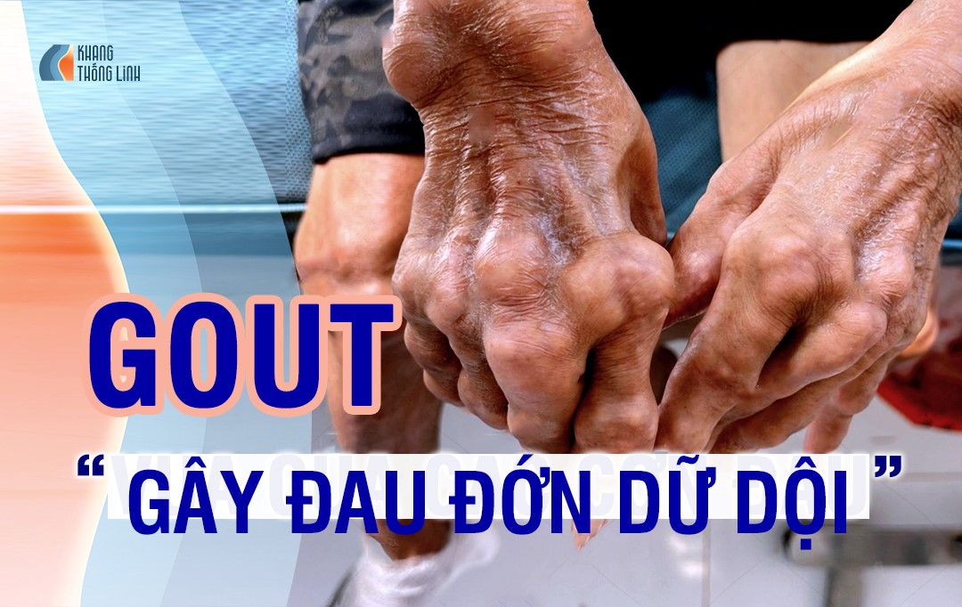 Cách giảm đau gout nhanh từ thảo dược