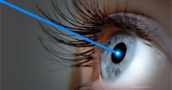 Các loại tia laser trong phẫu thuật khúc xạ