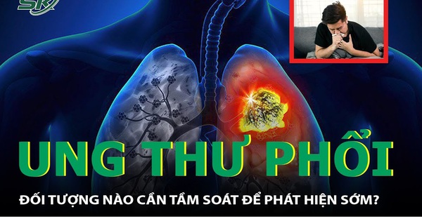 Bất ngờ phát hiện ung thư phổi chỉ từ 3 dấu hiệu đơn giản