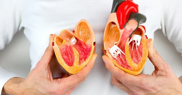 Chế độ ăn cho bệnh nhân trước và sau mổ u tim