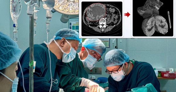 U gan 2 cm 'phình' lên 20 cm do tự điều trị bằng thuốc nam