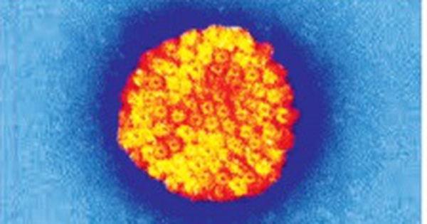 Viêm não do virut herpes âm thầm mà nguy hiểm