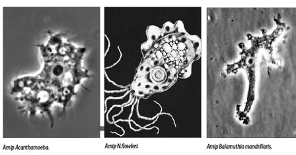 Điểm mặt các amip tự do gây viêm não