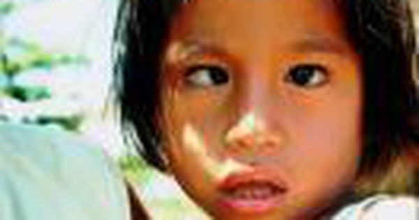 Biểu hiện trẻ bị quáng gà